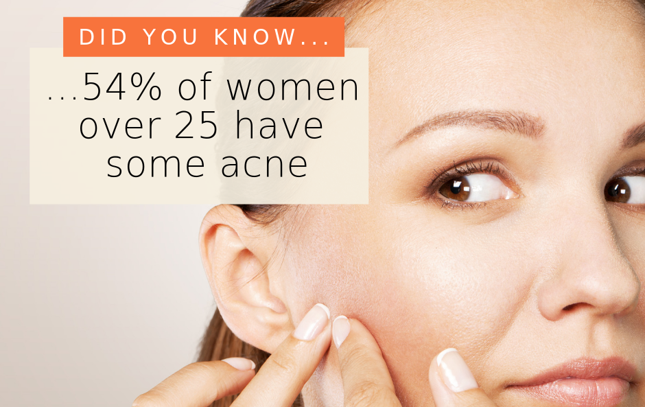 Tips for Adult Acne and Why Is Adult Acne on the Rise? : News & Updates ...